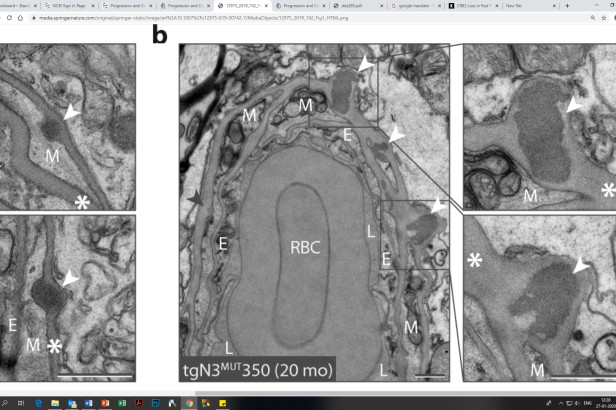 GOM deposits in small arteries - Cell & Chemical Biology